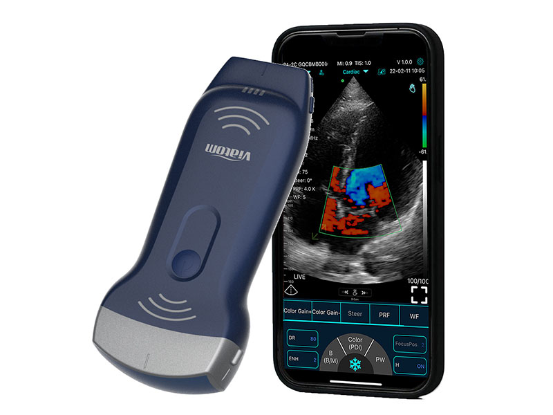 Curvilinear Probe Ultrasound Supplier | Deep Tissue Imaging