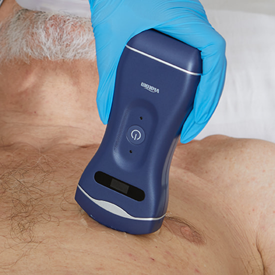 Phased Array Ultrasound Supplier | In-depth Cardiac & Vascular Imaging